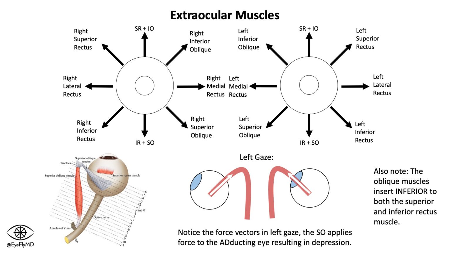 EyeFlyMD Educational Slides - Eye Fly MD