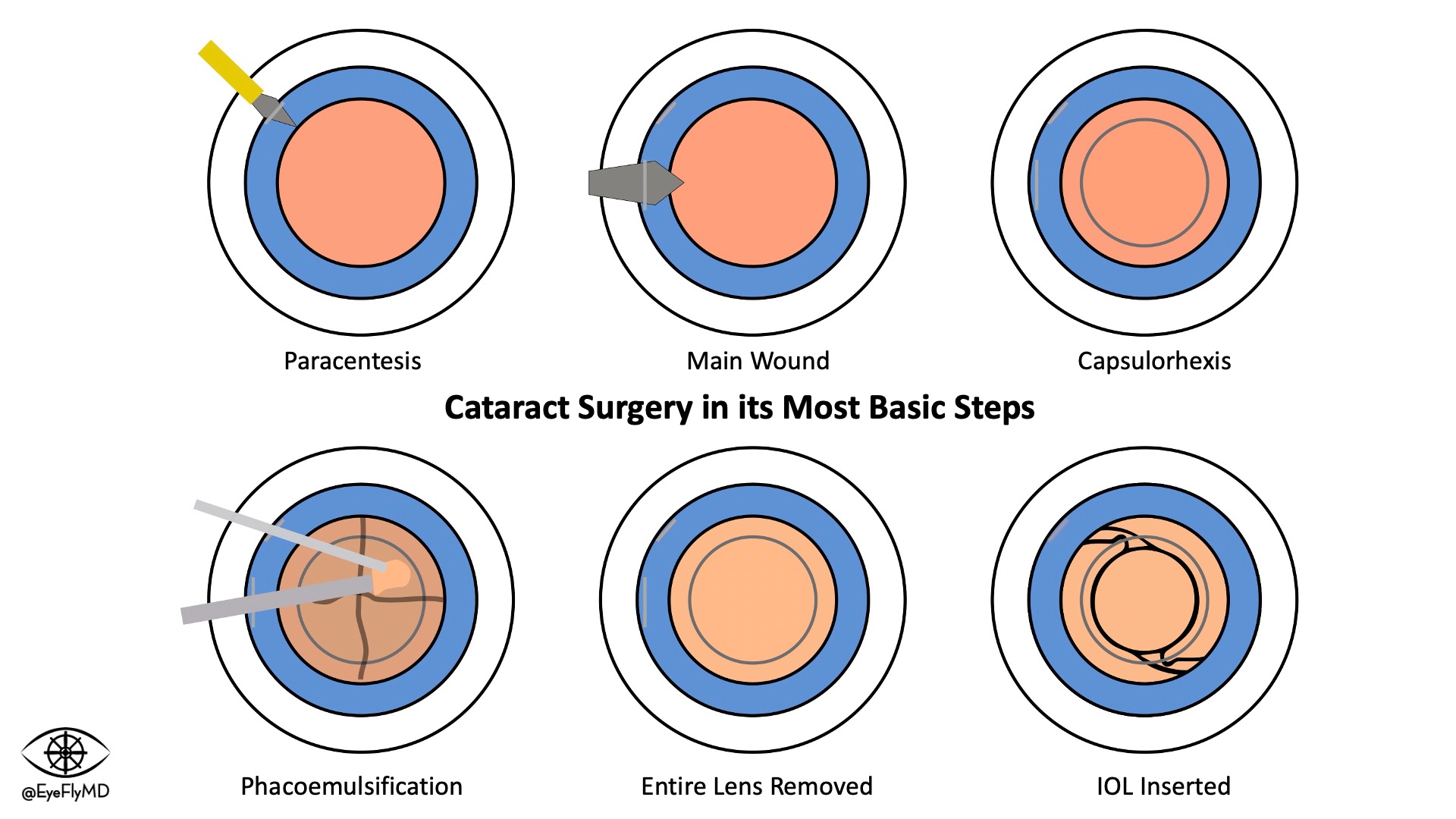 Educational and Matching in Ophthalmology Resources - Eye Fly MD