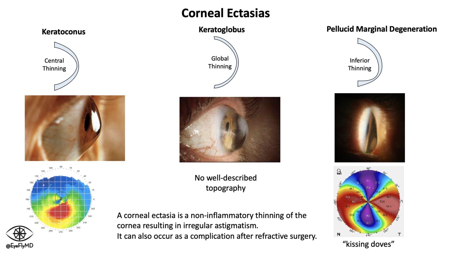 EyeFlyMD Educational Slides - Eye Fly MD