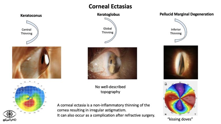 EyeFlyMD Educational Slides - Eye Fly MD