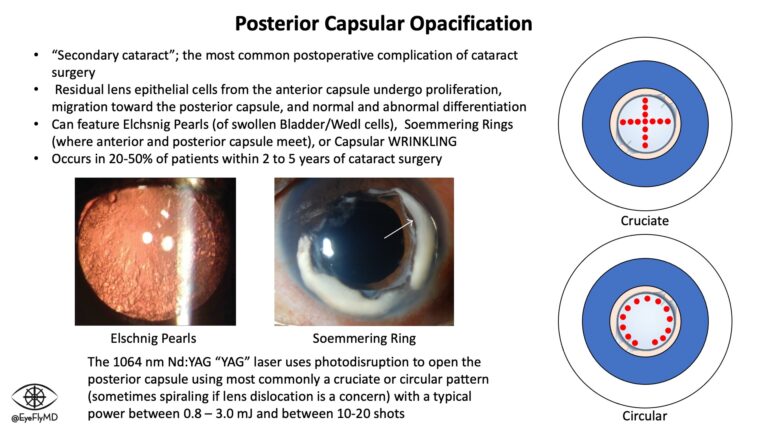 Educational and Matching in Ophthalmology Resources - Eye Fly MD
