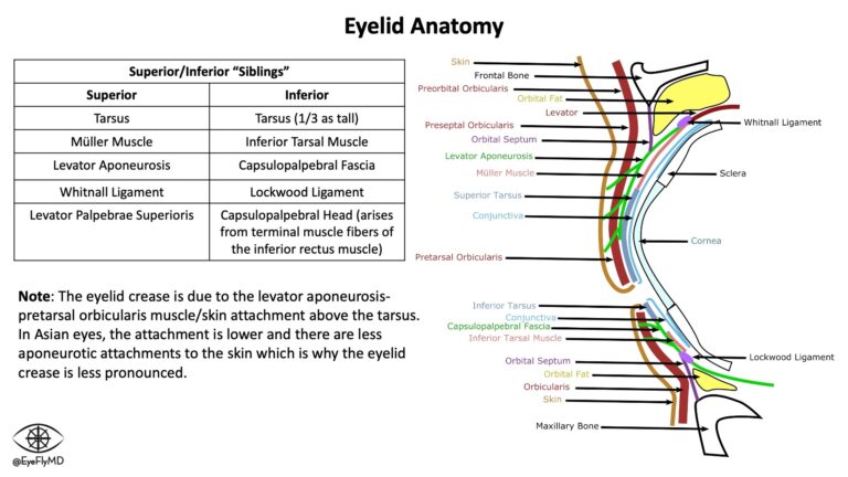 EyeFlyMD Educational Slides - Eye Fly MD